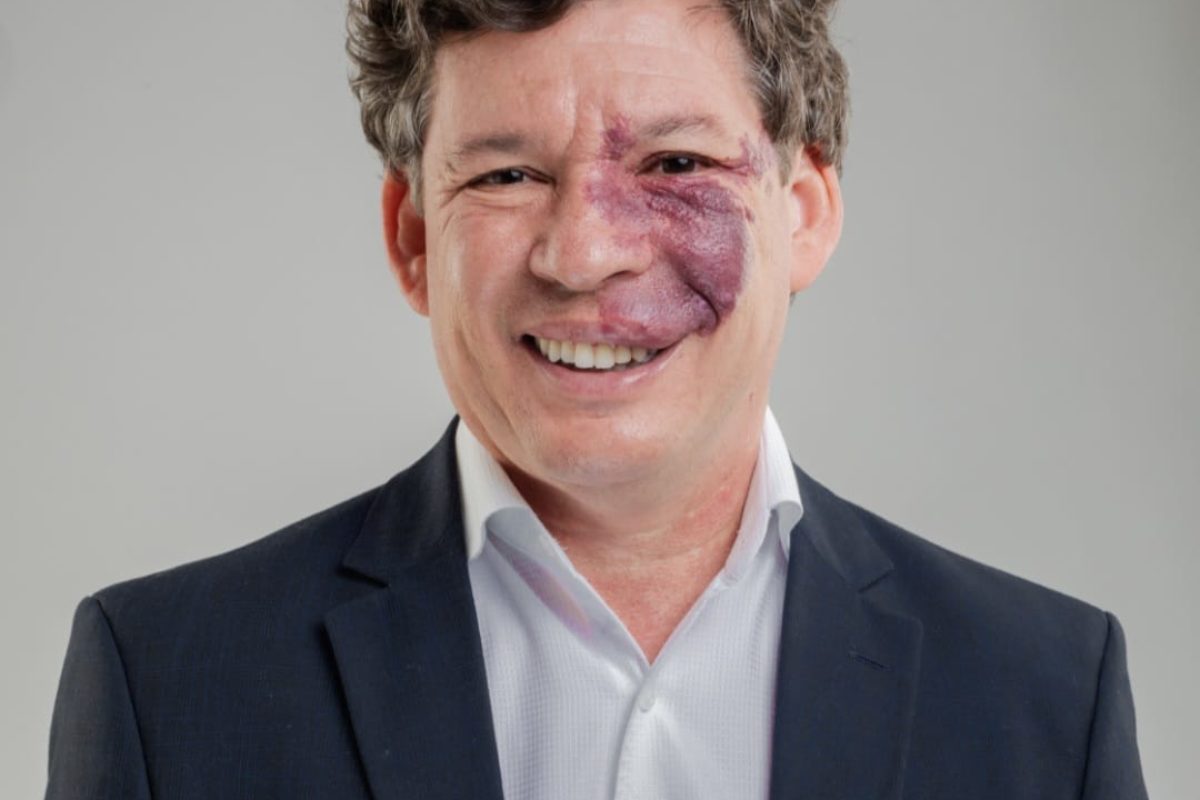 ‘Temos pior sistema tributário do planeta’, diz deputado Reginaldo Lopes | InvestNews